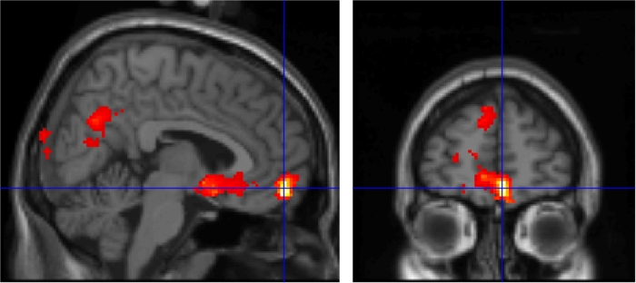 Can Brain Scans Predict Whose Love Will Last - The Anatomy Of Love